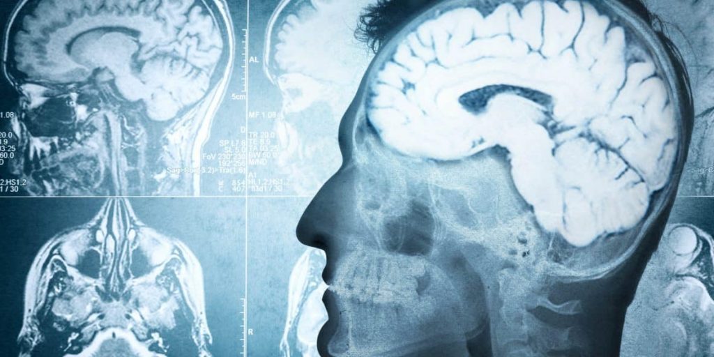 Alcohol Psychosis: Symptoms, Causes & Treatment | Orlando Recovery Center